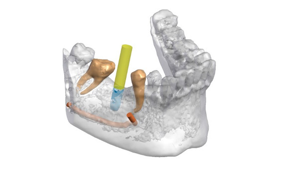 Order and Plan | Digital Solutions | Dentsply Sirona